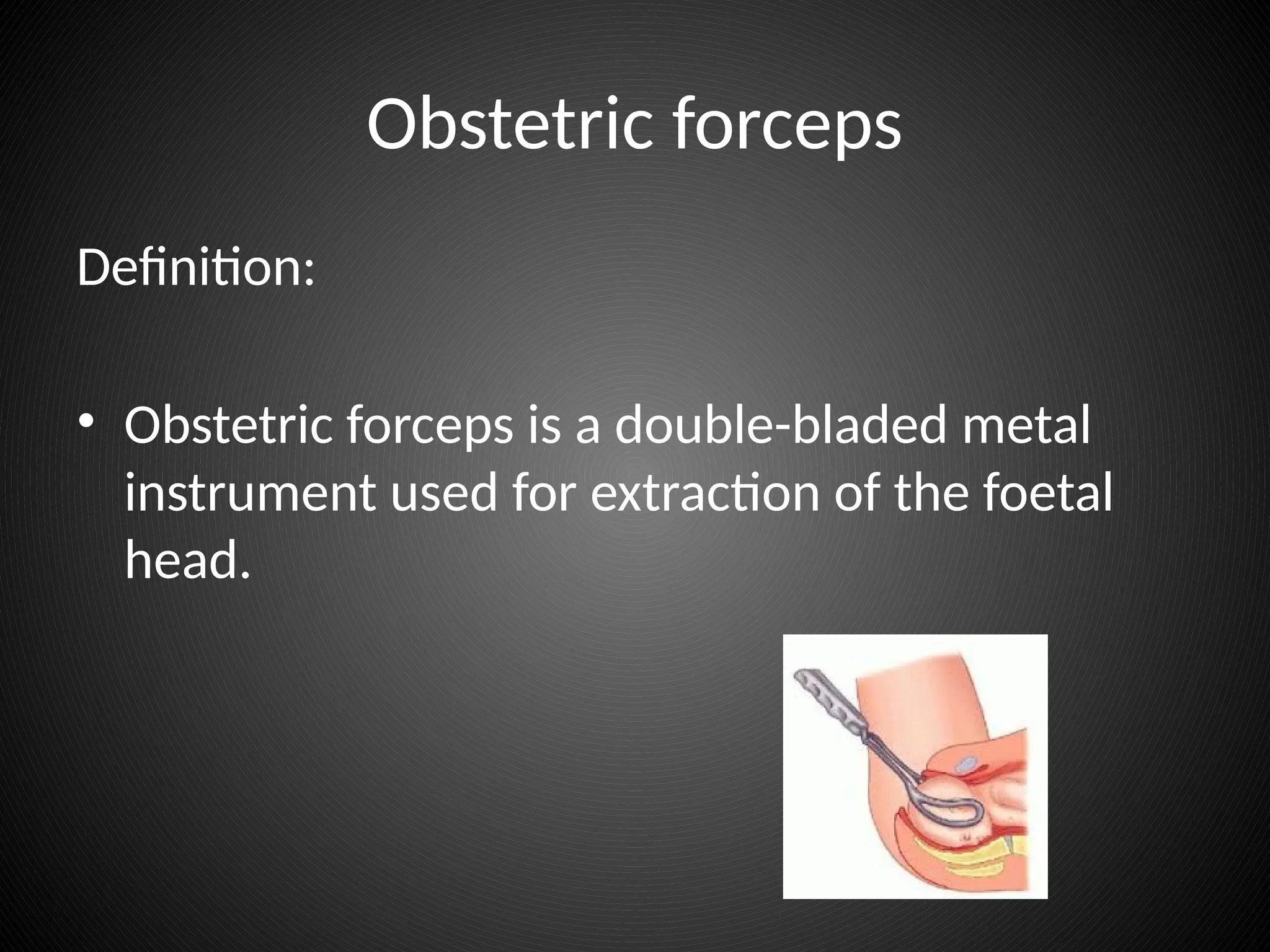 FORCEPS DELIVERY types ,steps,management ppt | PPTX