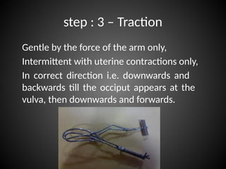 FORCEPS DELIVERY types ,steps,management ppt | PPT