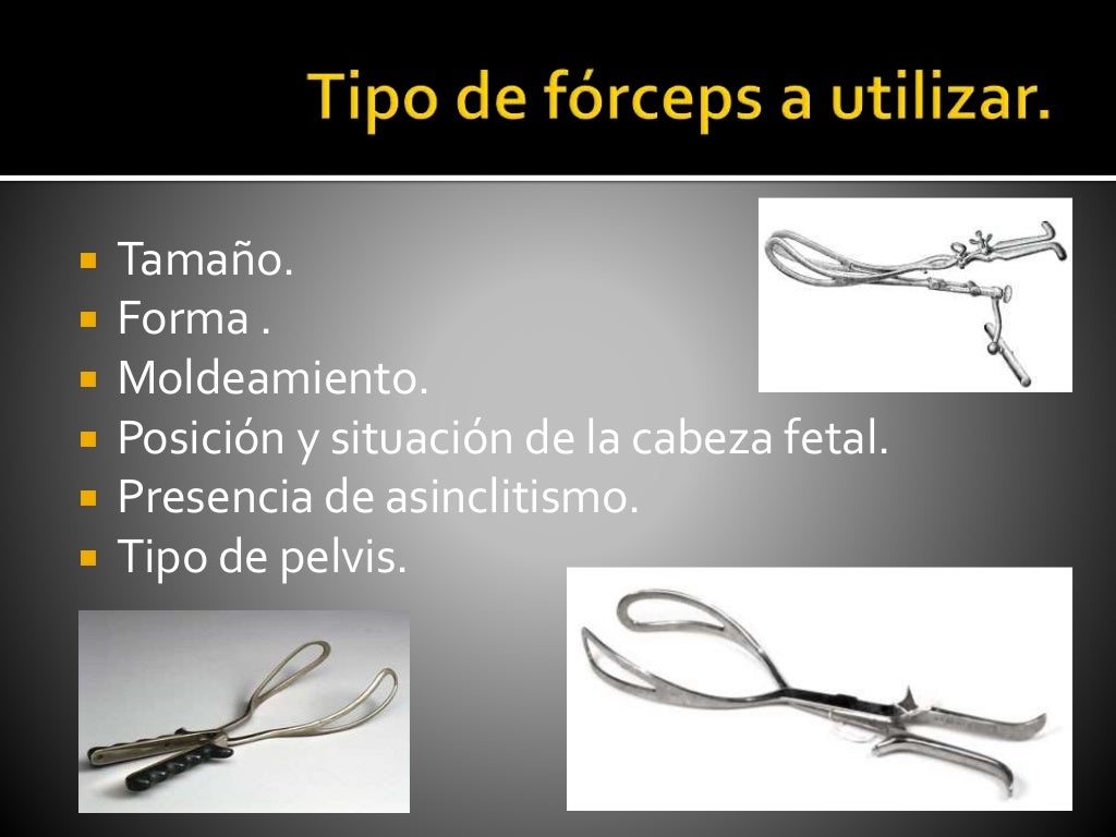 Tipos De Forceps Parto – El parto: preparación, tipos y posibles ...