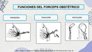 Forceps sala de parto 2024 técnica, riesgos y beneficio | PPTX