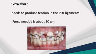 Types of tooth movement orthodontic.pptx