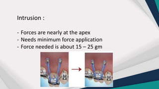 Types of tooth movement orthodontic.pptx