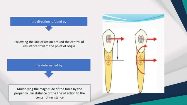 Types of tooth movement orthodontic.pptx