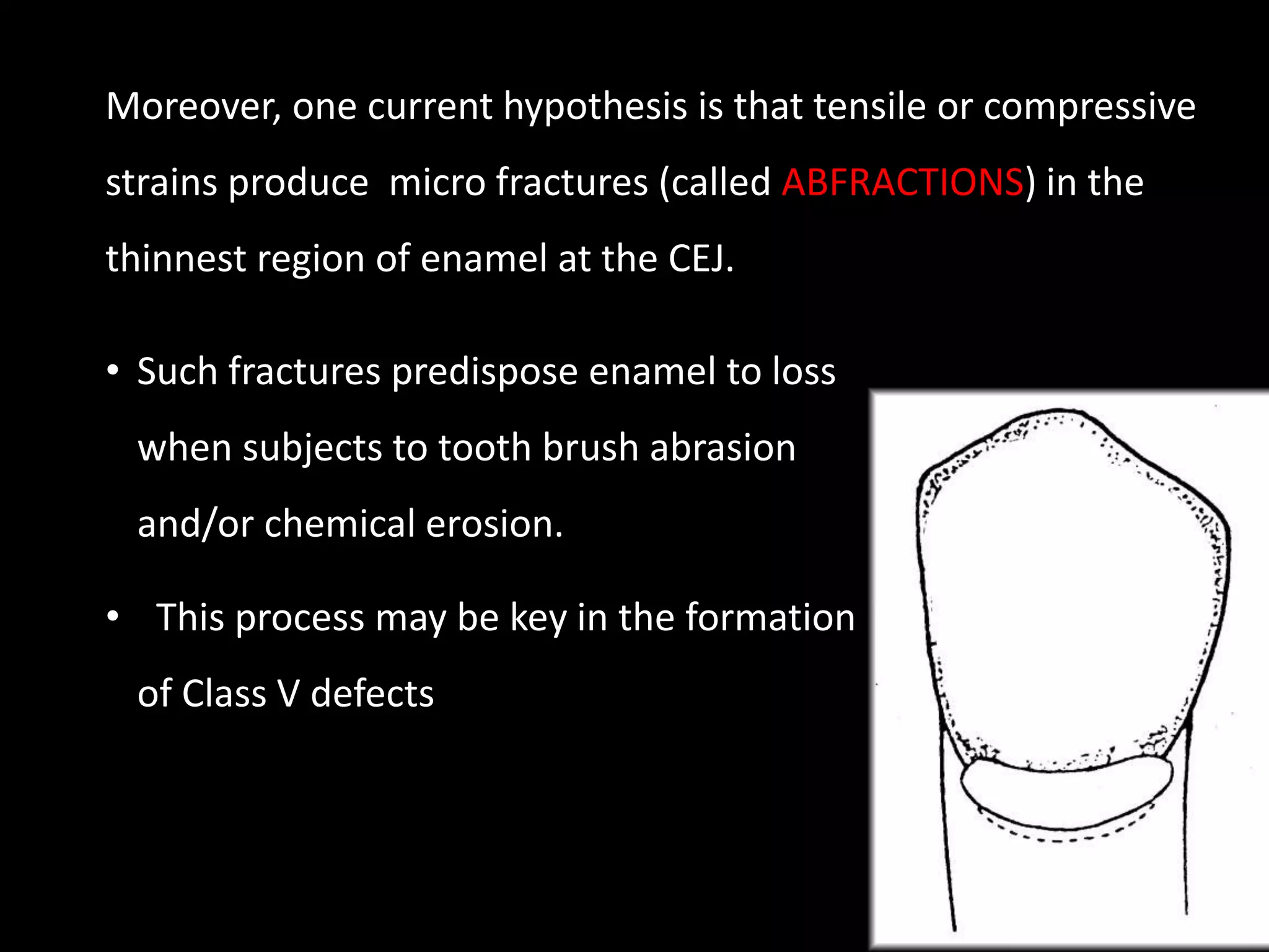 Forces acting on restoration | PPTX