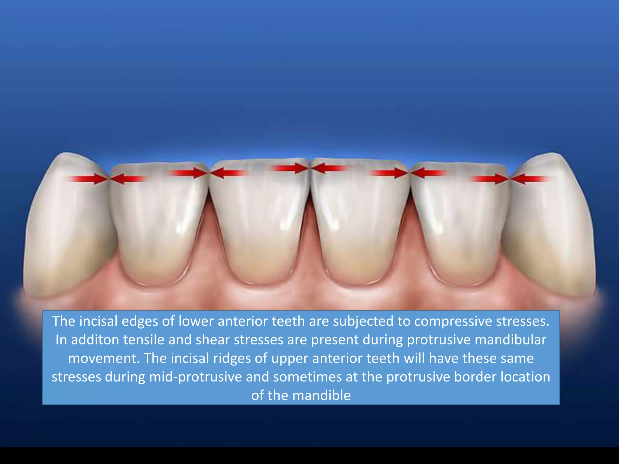 Forces acting on restoration | PPTX
