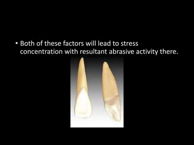 Forces acting on restoration | PPT