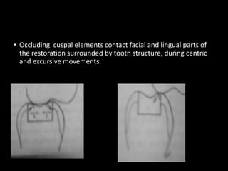Forces acting on restoration | PPTX