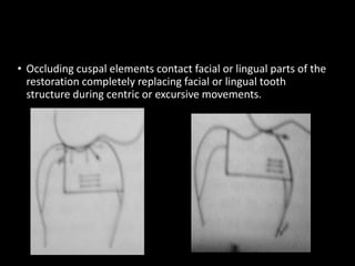 Forces acting on restoration | PPTX