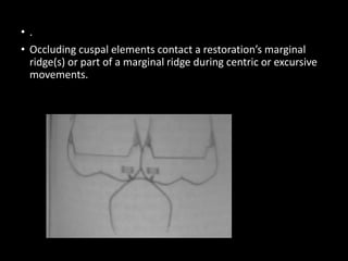Forces acting on restoration | PPTX