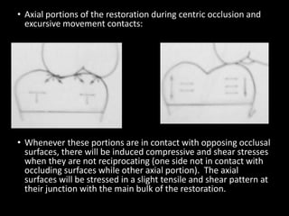 Forces acting on restoration | PPTX