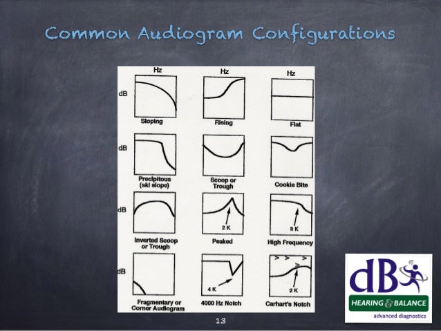 Hearing Basics and Importance of Hearing