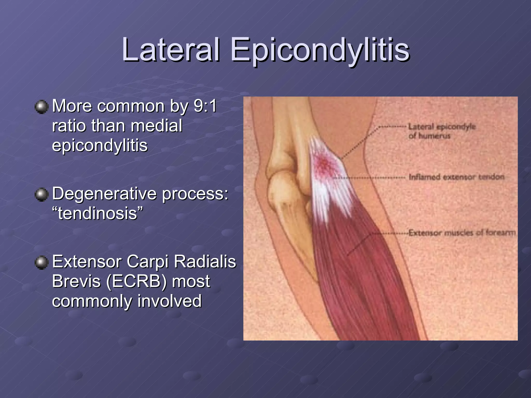 Forearm And Elbow Pathologies Dr. Mark Davies Sjsu, Spring 2008 | PPT
