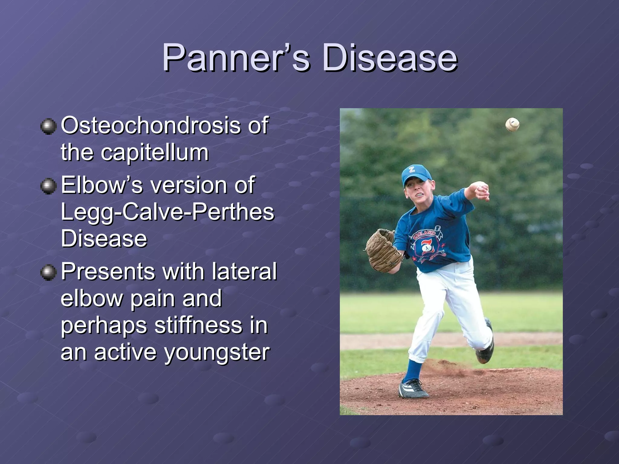 Forearm And Elbow Pathologies Dr. Mark Davies Sjsu, Spring 2008 | PPT