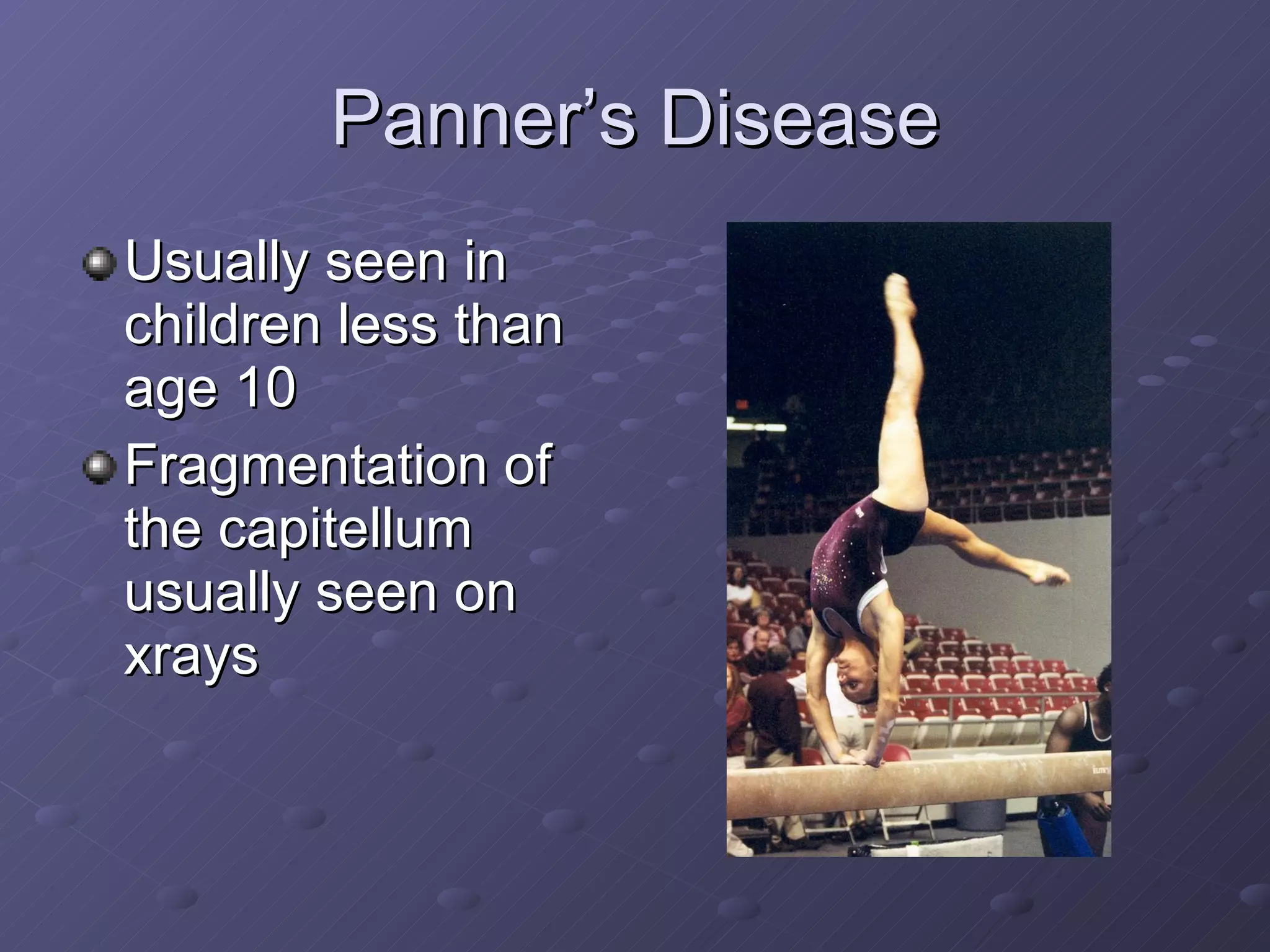 Forearm And Elbow Pathologies Dr. Mark Davies Sjsu, Spring 2008 | PPT