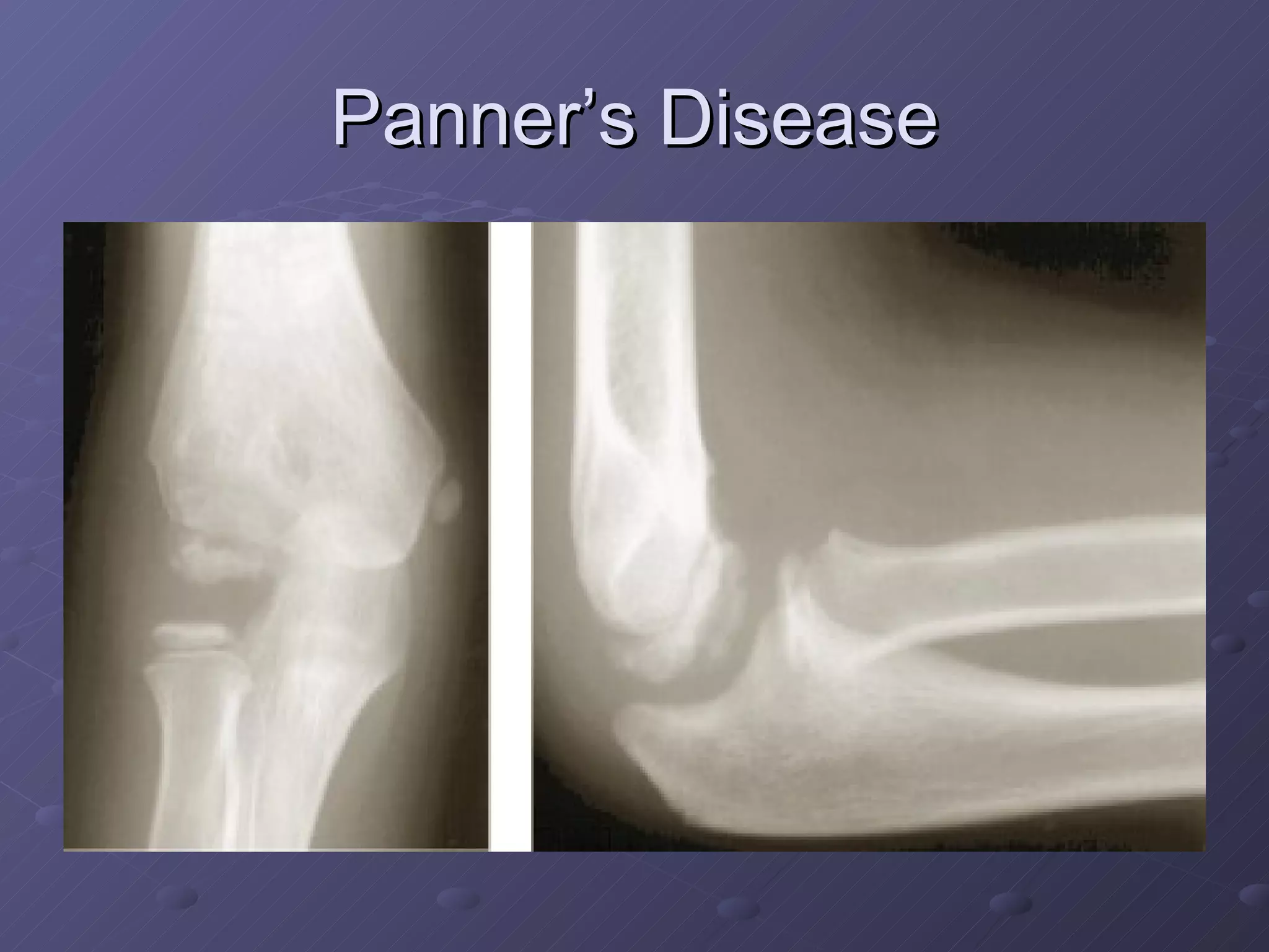 Forearm And Elbow Pathologies Dr. Mark Davies Sjsu, Spring 2008 | PPT