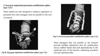 Forearm based and hand-finger-thumb orthosis | PPTX