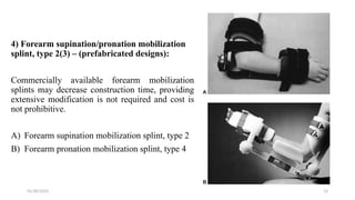 Forearm based and hand-finger-thumb orthosis | PPTX