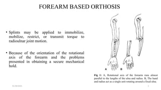 Forearm based and hand-finger-thumb orthosis | PPTX