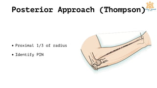 Forearm fracture, A Wednesday child in upper extremity fracture | PPT
