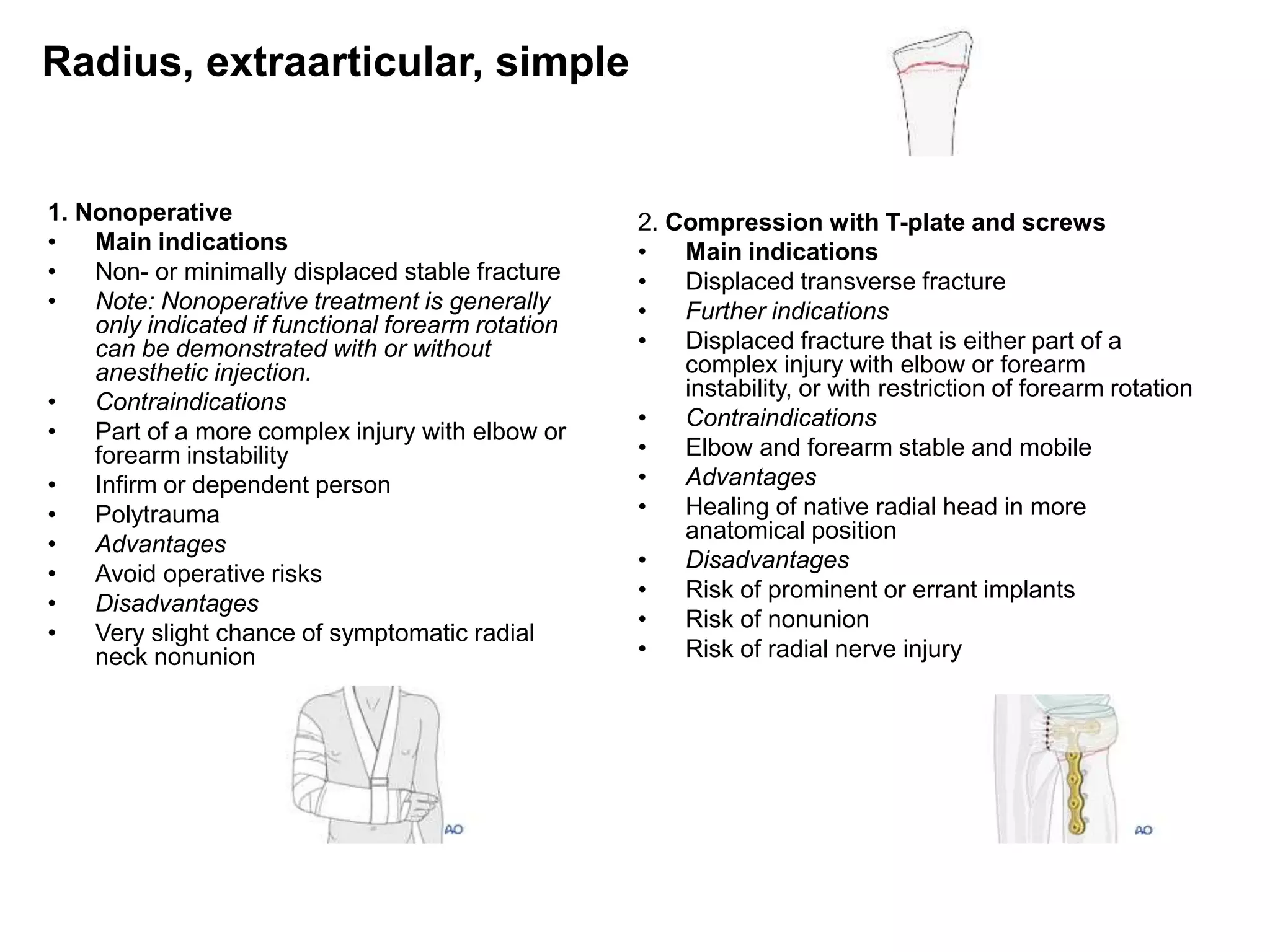 Forearm fracture indication AO | PPT