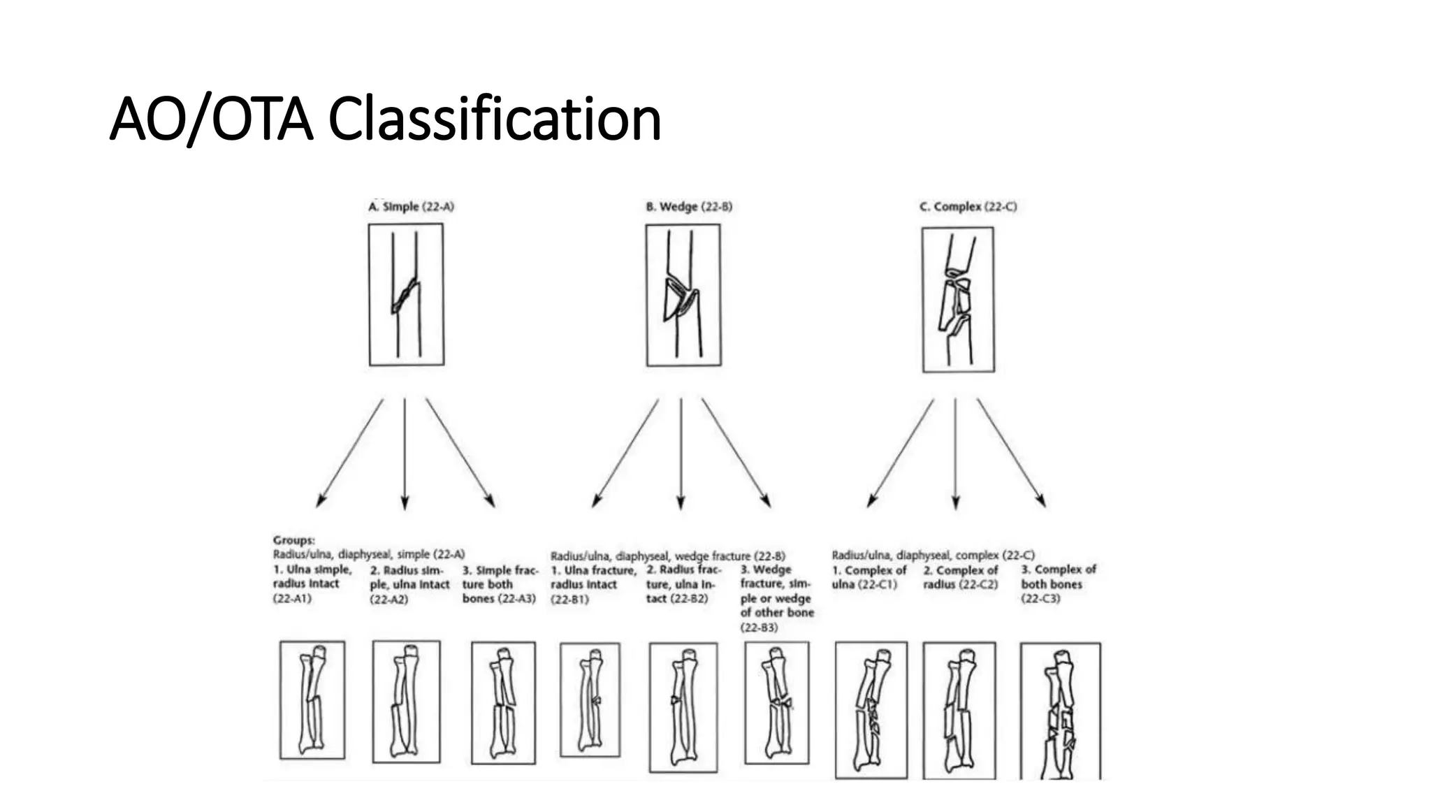 Forearm Fractures of Adults | PPTX