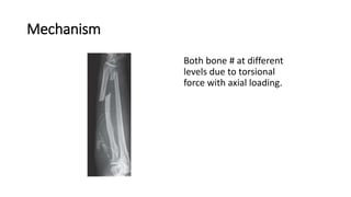 Forearm Fractures of Adults | PPTX