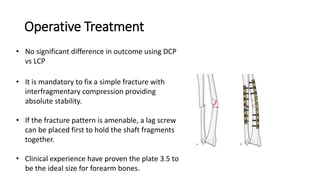 Forearm Fractures of Adults | PPTX