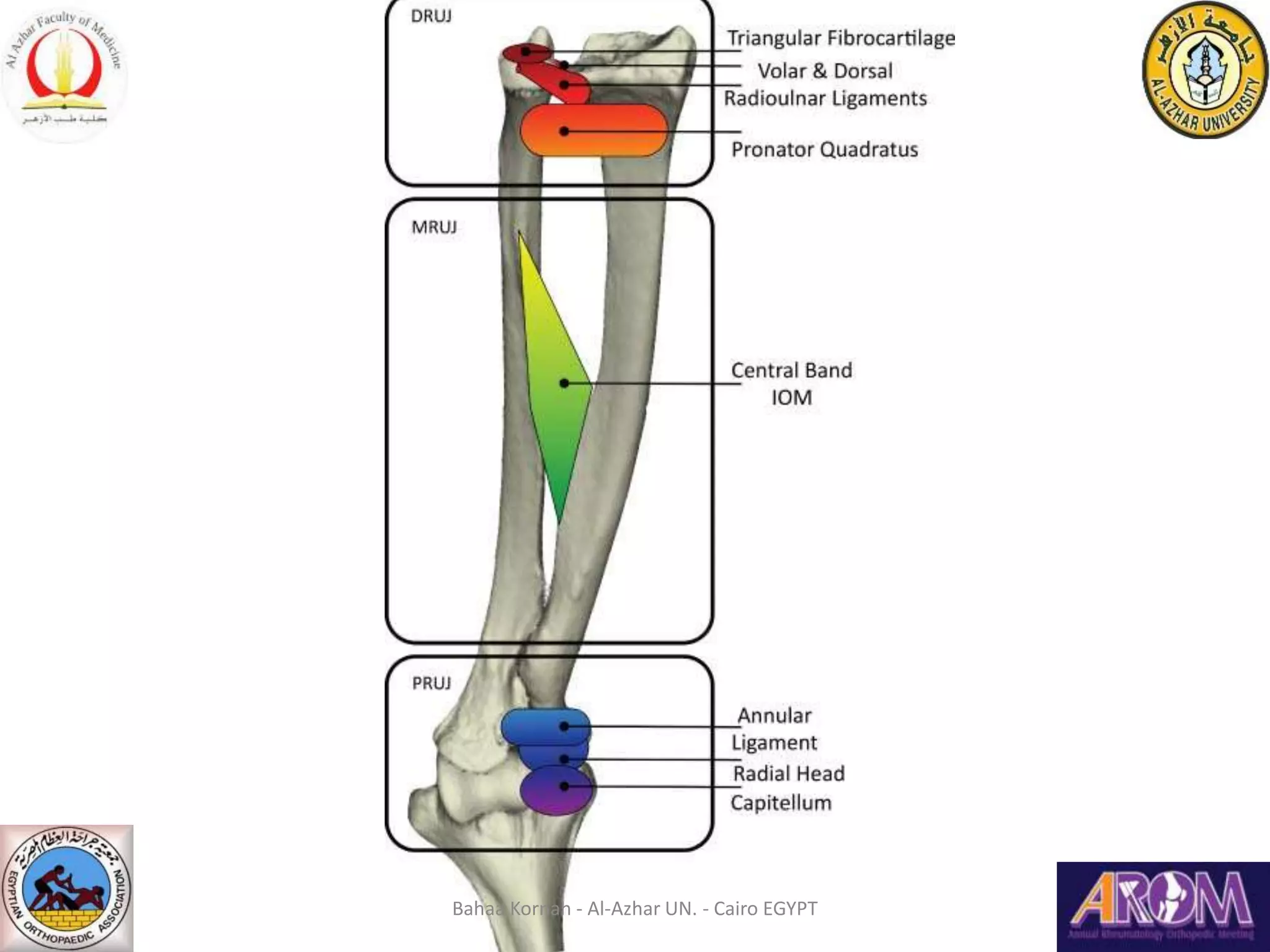 Forearm instability | PPT