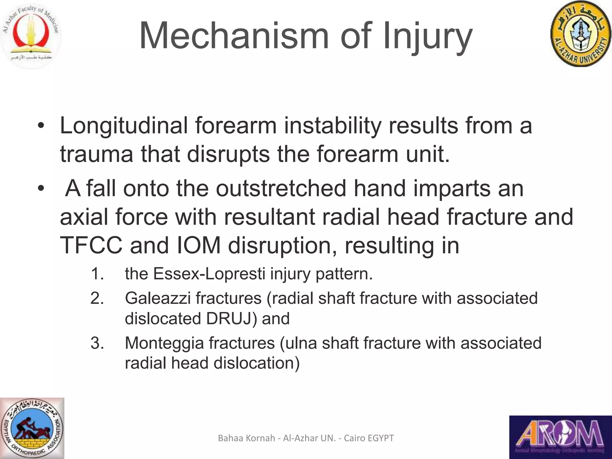 Forearm instability | PPT