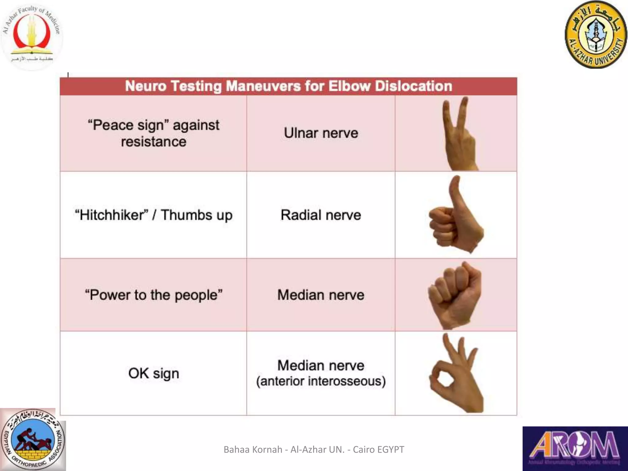 Forearm instability | PPT