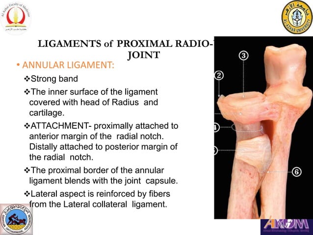 Forearm instability | PPT