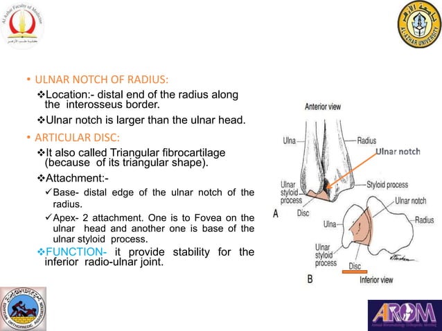 Forearm instability | PPT