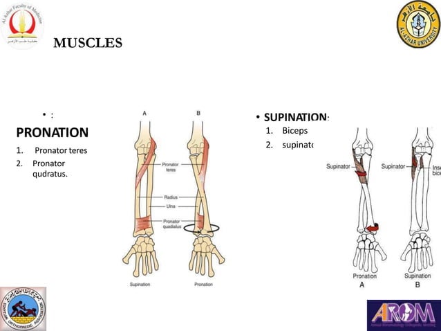 Forearm instability | PPT
