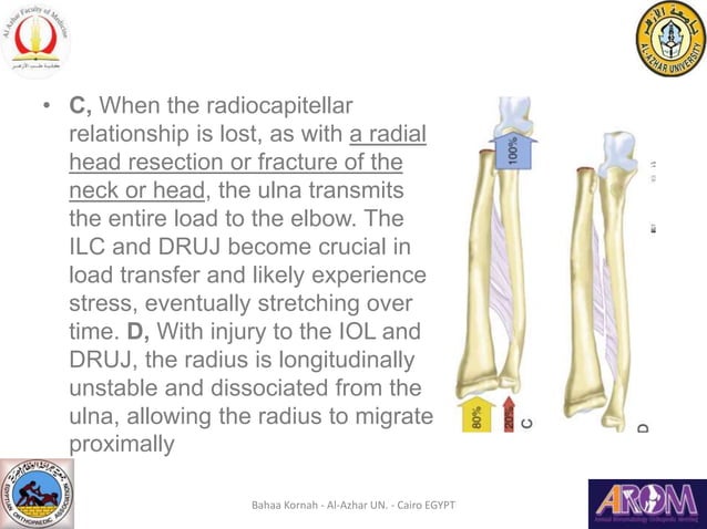 Forearm instability | PPT