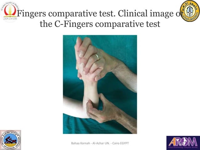 Forearm instability | PPT