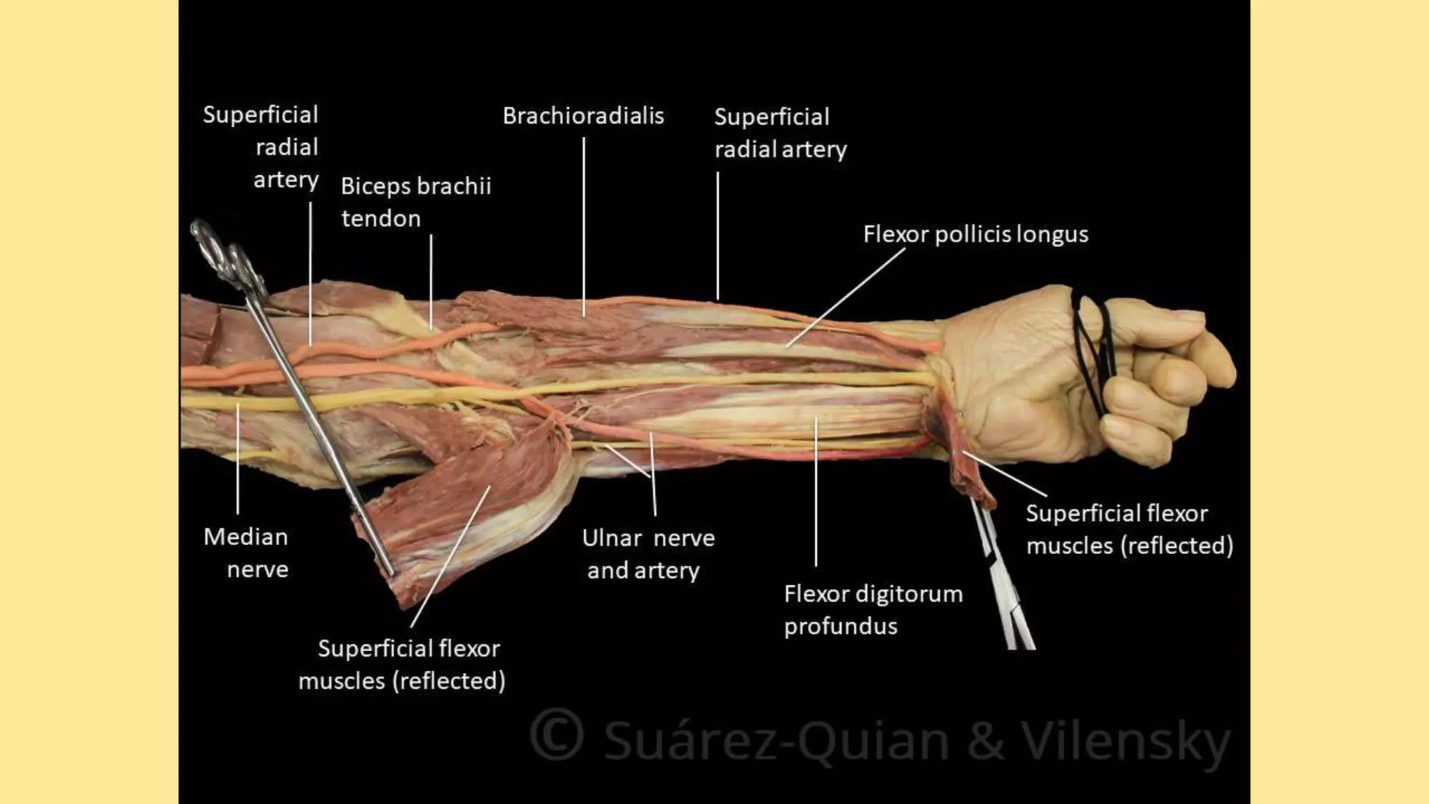 Forearm muscles anterior (flexor) compartment | PPTX