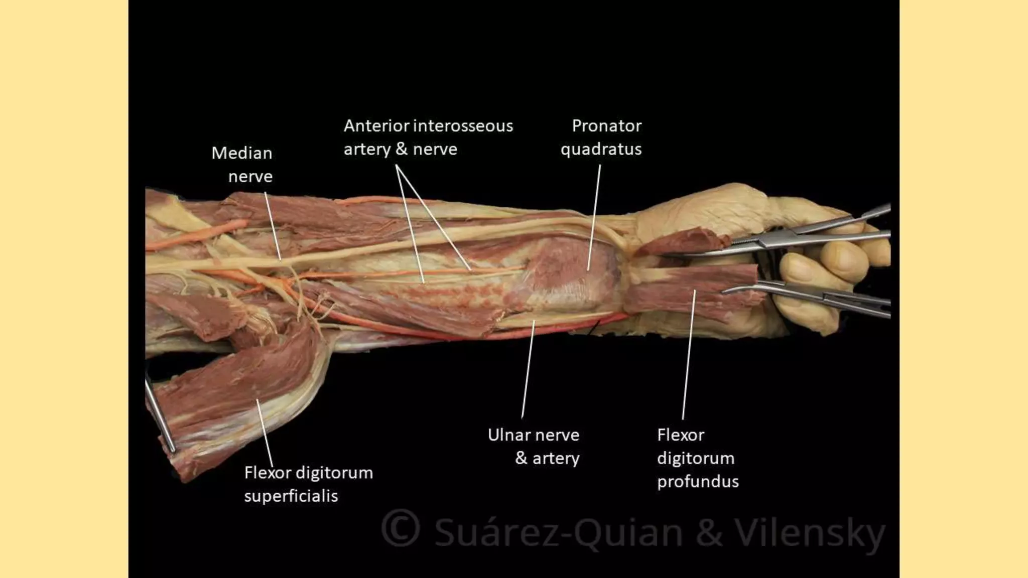 Forearm muscles anterior (flexor) compartment | PPTX