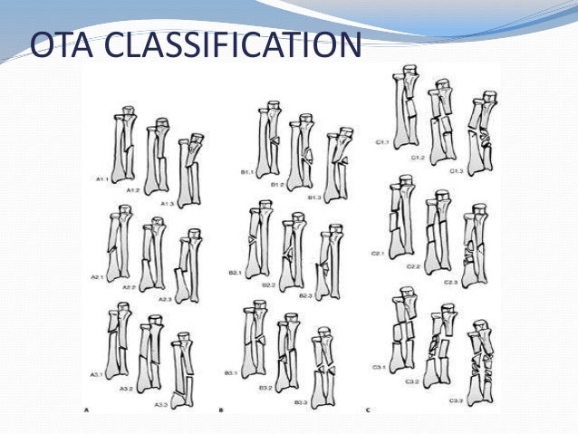 Forearm shaft fractures