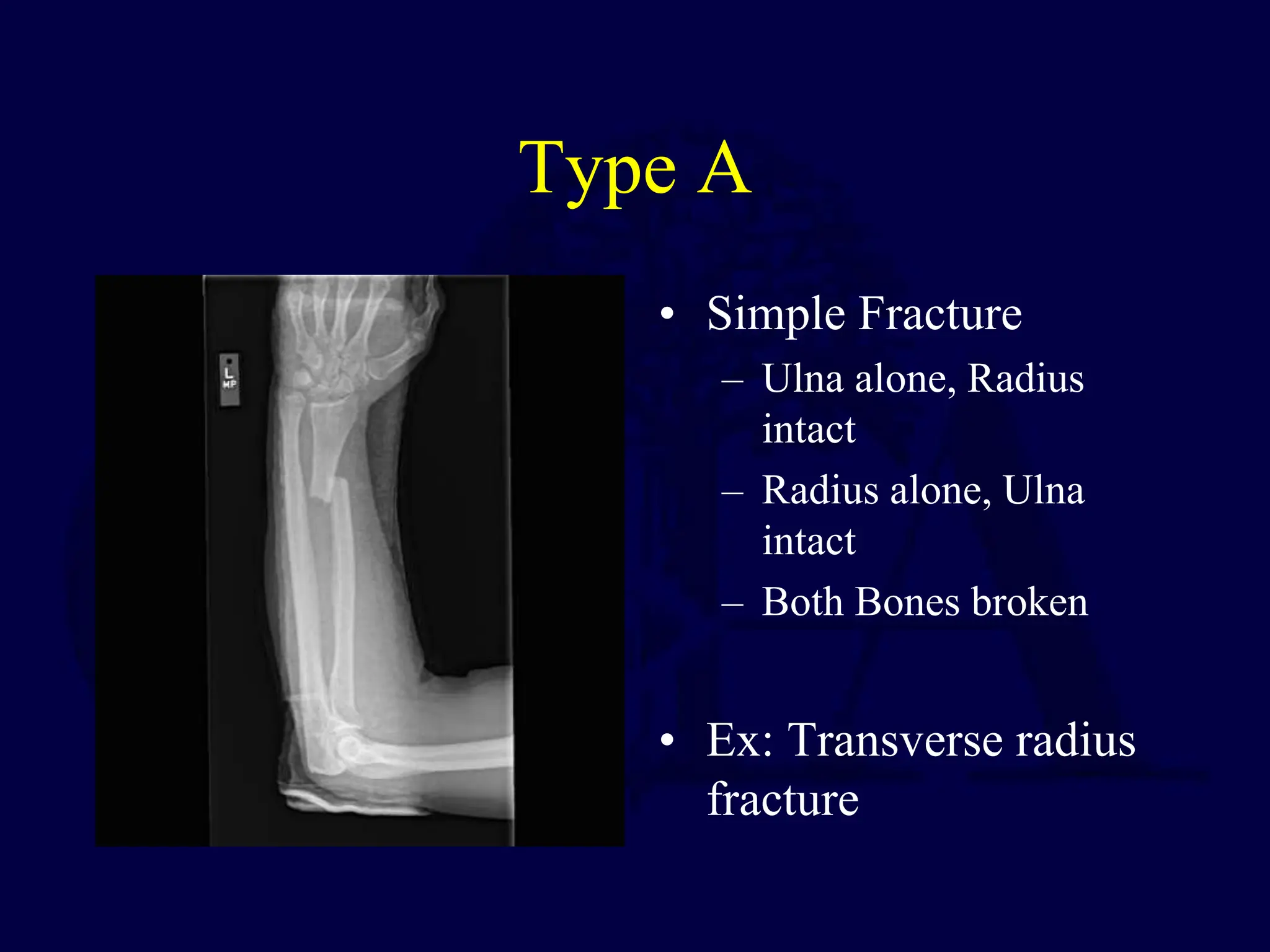 FOREARM TRAUMA. .pptx. | PPTX
