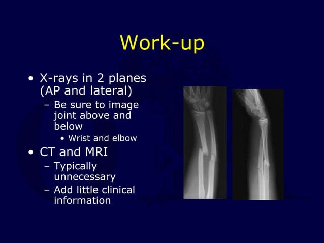 FOREARM TRAUMA. .pptx. | PPTX