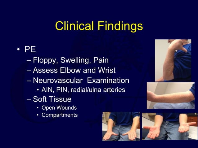 FOREARM TRAUMA. .pptx. | PPTX