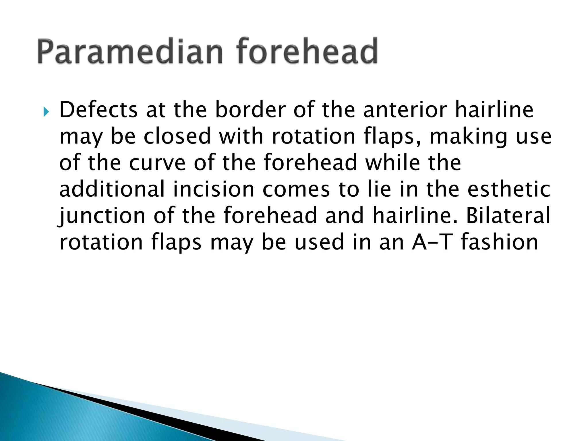 Forehead defects reconstruction | PPTX