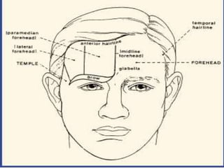 Forehead defects reconstruction | PPTX
