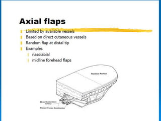 Forehead flap | PPTX