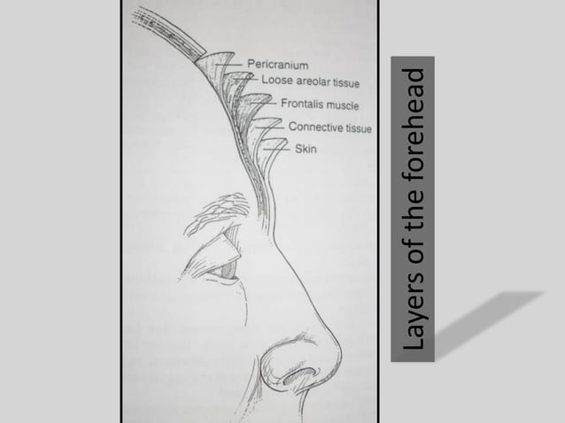 Forehead reconstructionn | PPTX