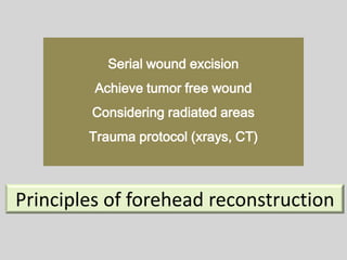 Forehead reconstructionn | PPTX