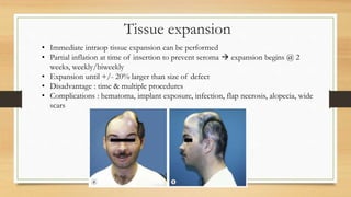 Forehead & scalp reconstruction.pptx