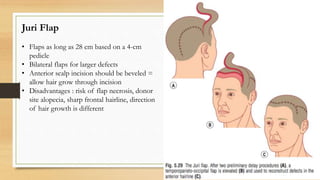 Forehead & scalp reconstruction.pptx