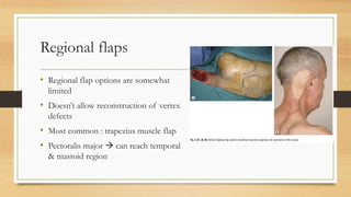 Forehead & scalp reconstruction.pptx
