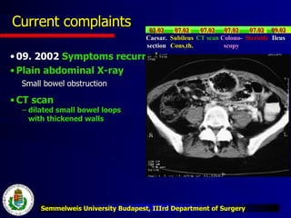 Foreign body | PPT